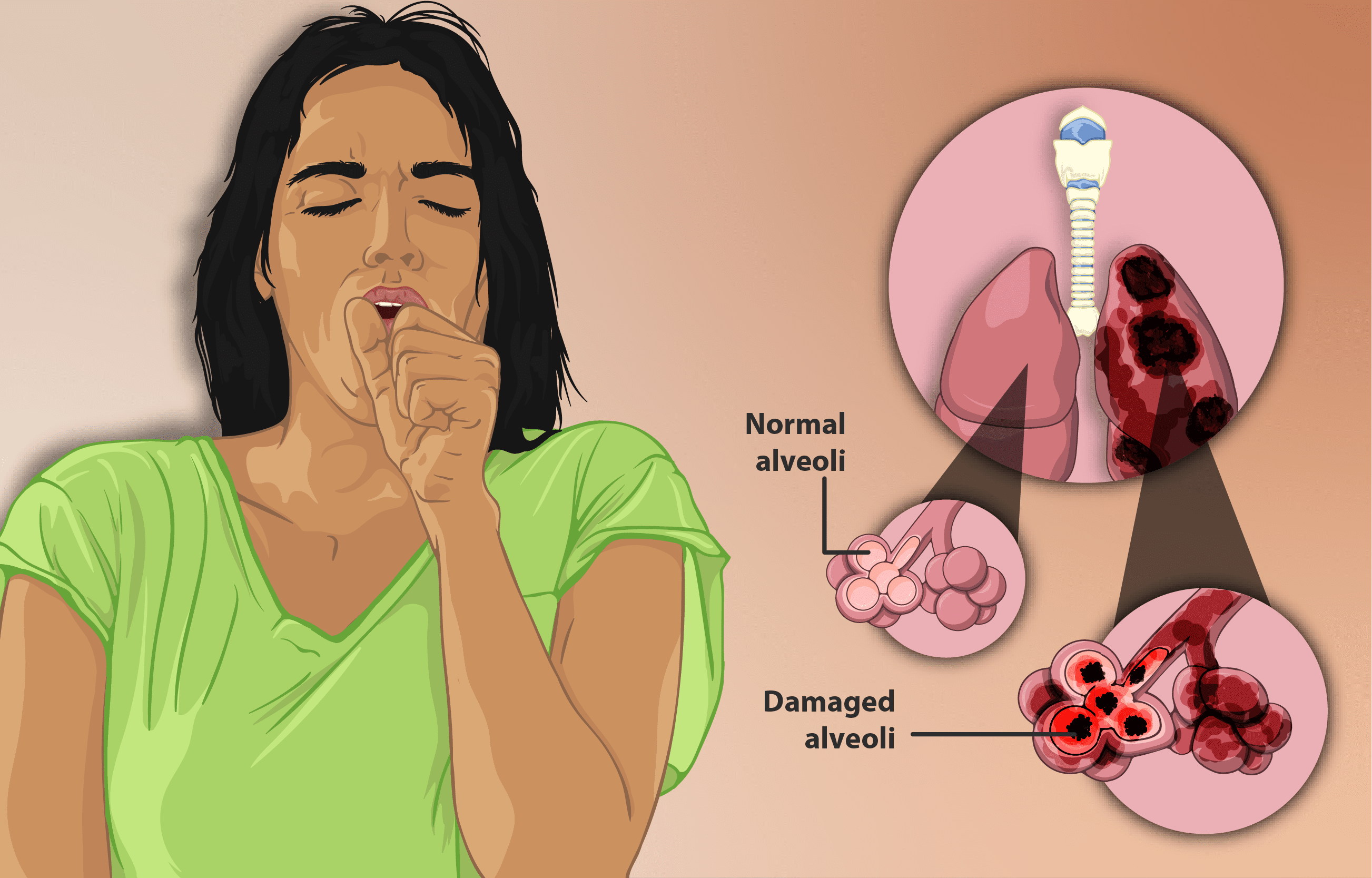 Respiratory Diseases - HESI | NurseHub