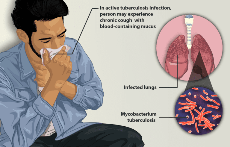 Respiratory Diseases - HESI | NurseHub