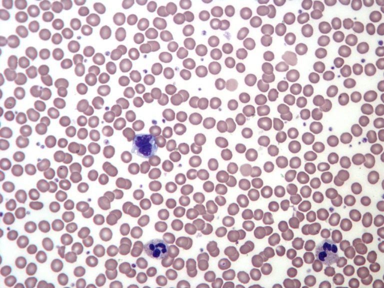 The Blood Lesson - TEAS | NurseHub